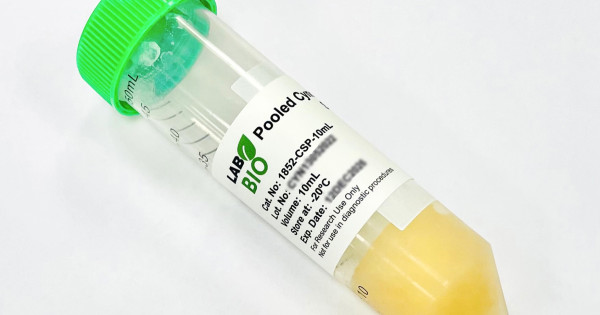 Pooled Cynomolgus Monkey Serum